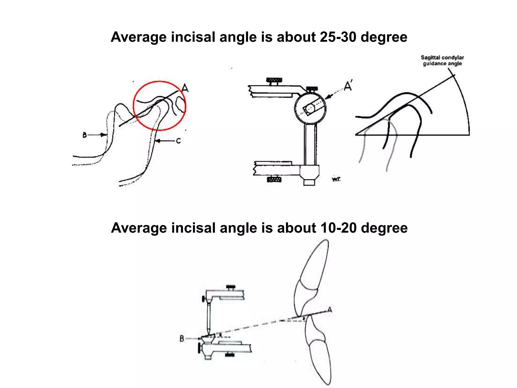 3- Occlusion in prosthodontics- Factors affecting balanced occlusion | PPTX