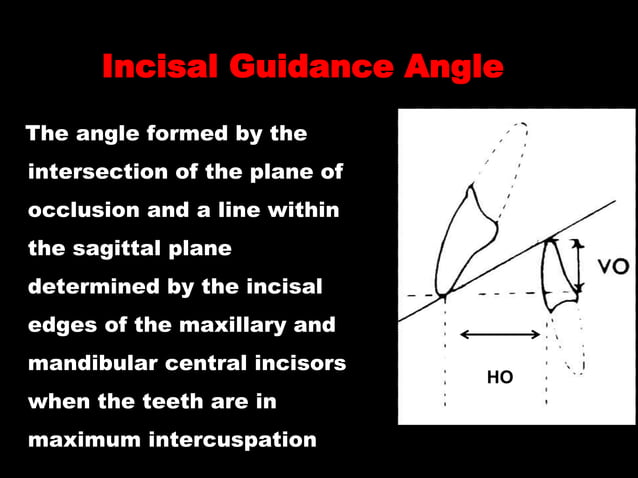 3- Occlusion in prosthodontics- Factors affecting balanced occlusion ...