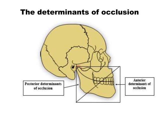 3- Occlusion in prosthodontics- Factors affecting balanced occlusion ...