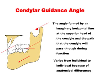 3- Occlusion in prosthodontics- Factors affecting balanced occlusion | PPT