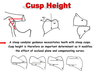 3- Occlusion in prosthodontics- Factors affecting balanced occlusion | PPT