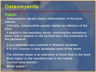 Osteomyelitis | PPT