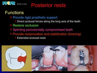 3.partial denture rests | PPT