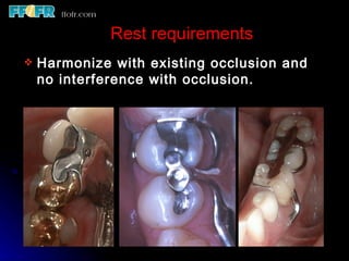 3.partial denture rests | PPT