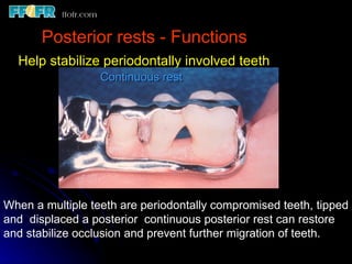 3.partial denture rests | PPT