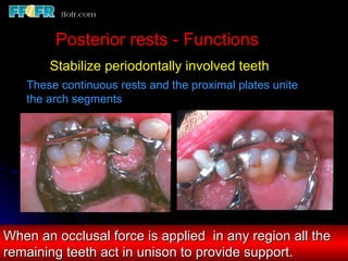 3.partial denture rests | PPT