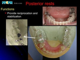 3.partial denture rests | PPT