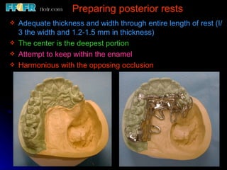 3.partial denture rests | PPT
