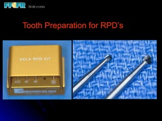 3.partial denture rests | PPT