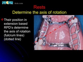 3.partial denture rests | PPT