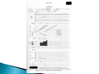 3 partograf | PPT
