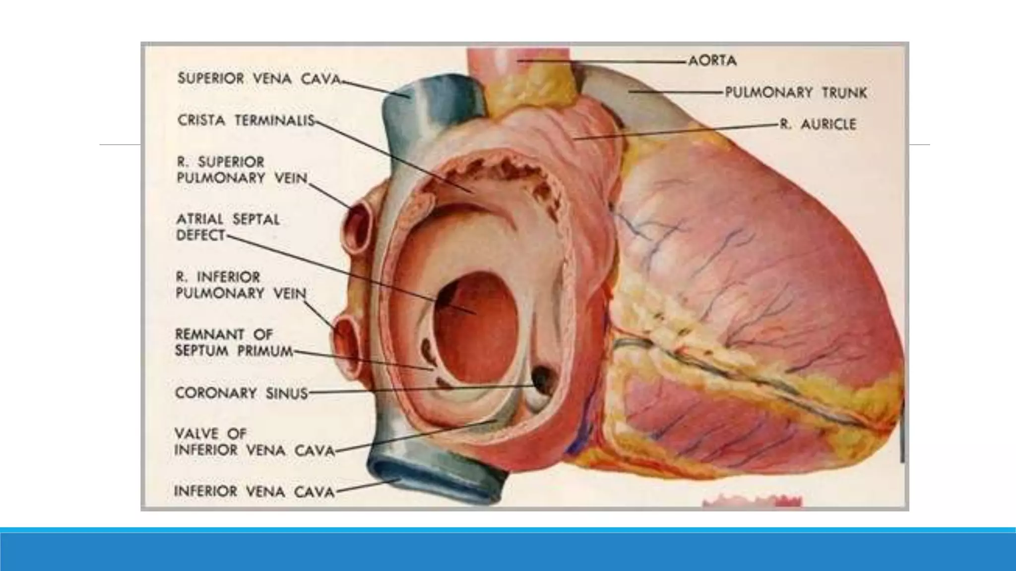 3-pericardium & Heart.pptx