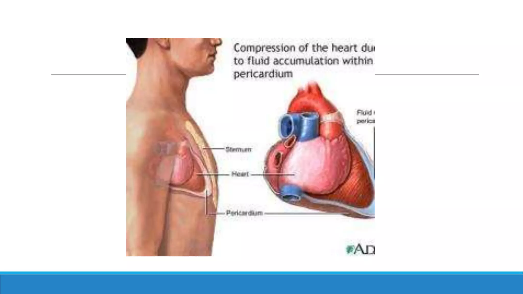 3-pericardium & Heart.pptx