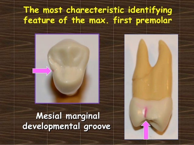 3 premolars
