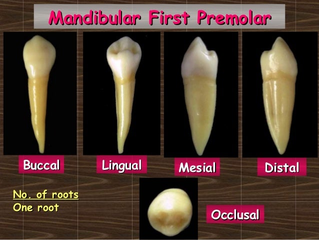 3 premolars