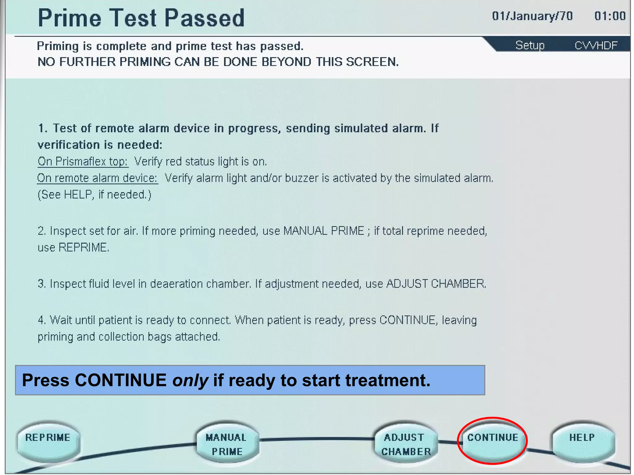 3 prismaflex basic setup operation | PPT