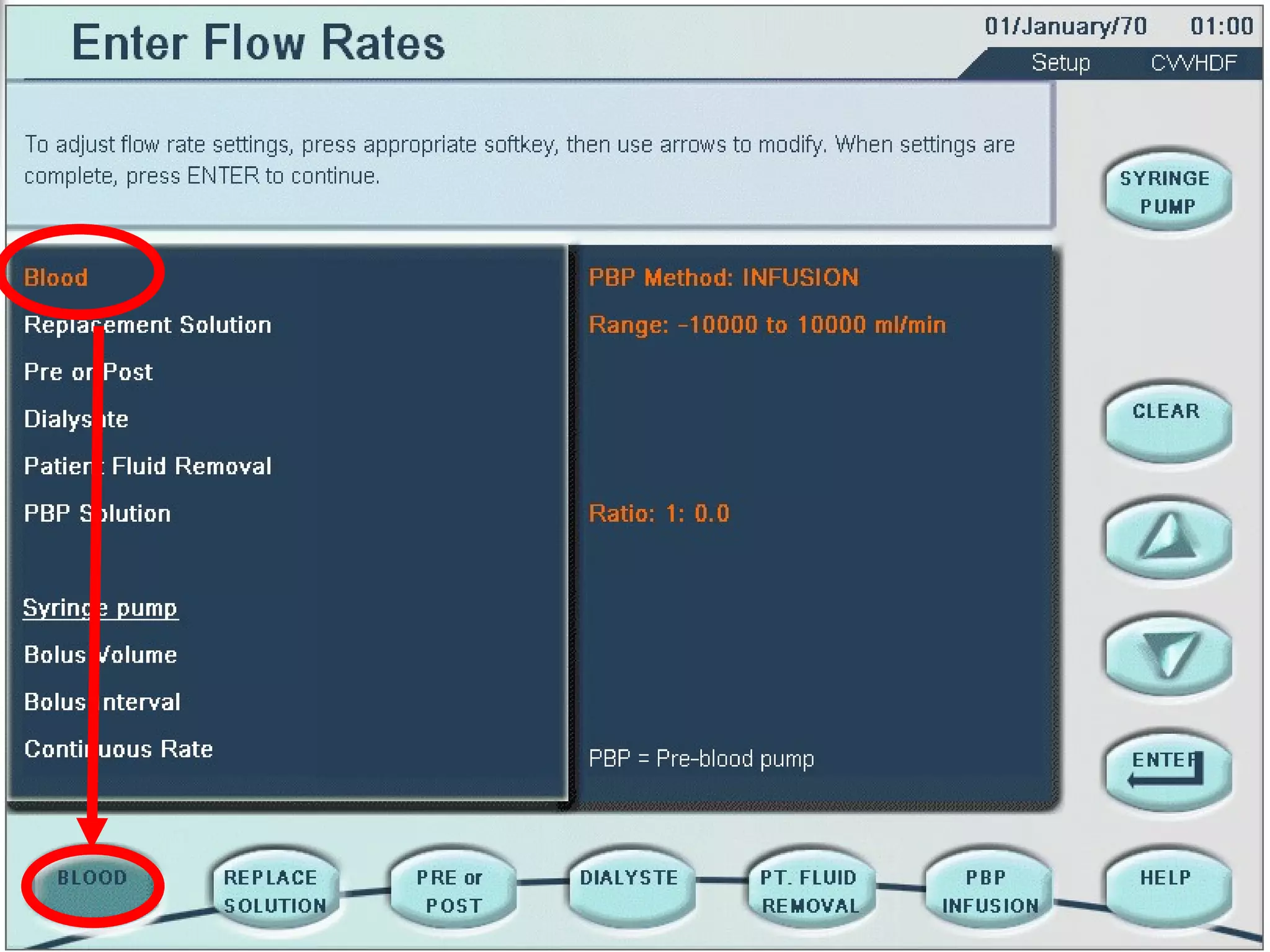 3 prismaflex basic setup operation | PPT