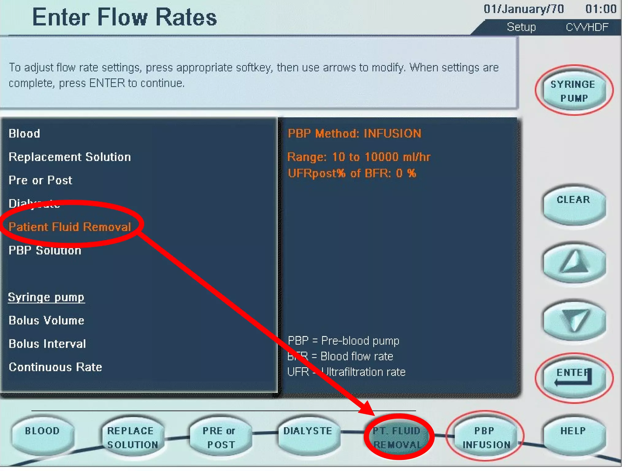 3 prismaflex basic setup operation | PPT
