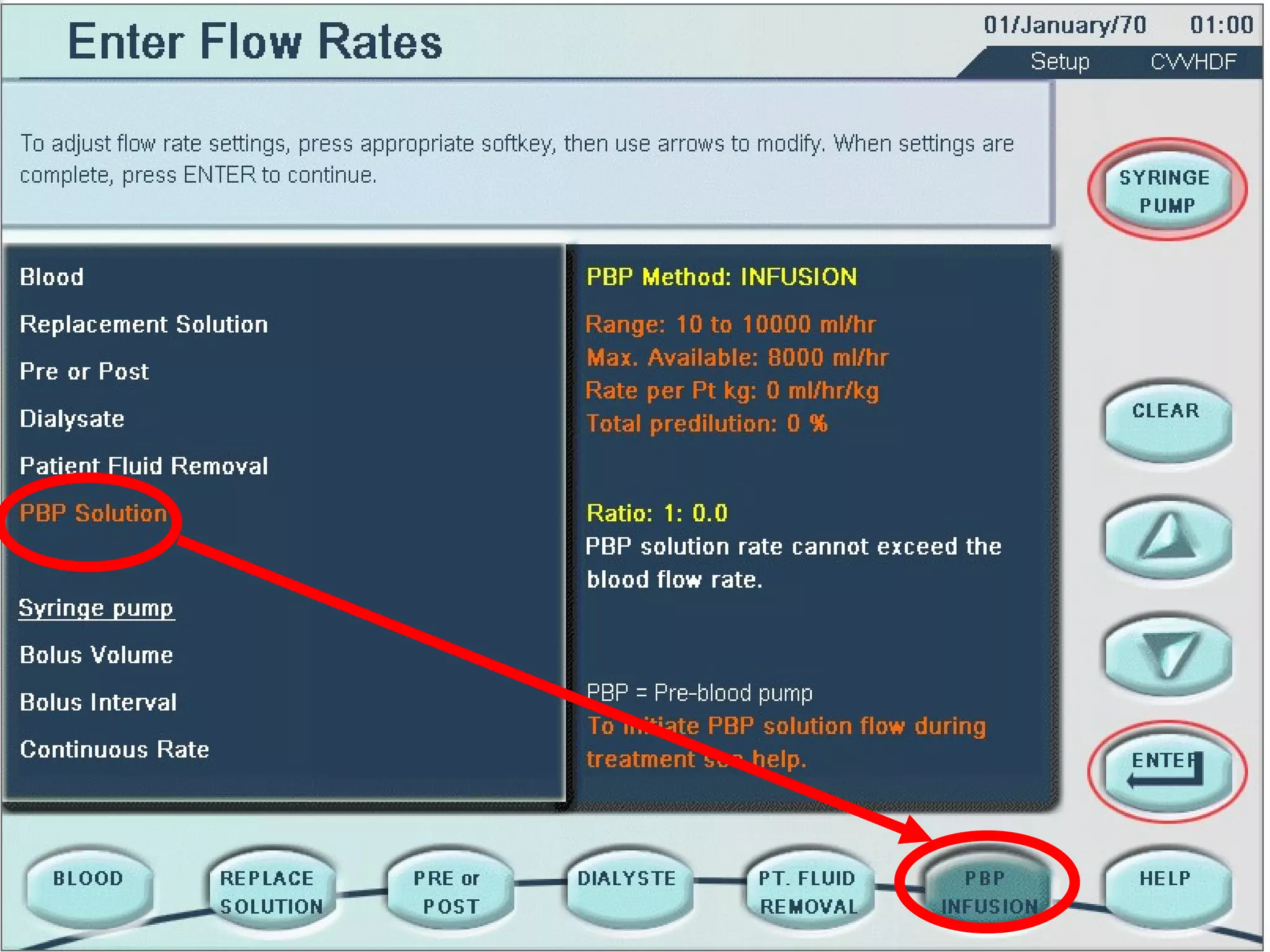 3 prismaflex basic setup operation | PPT