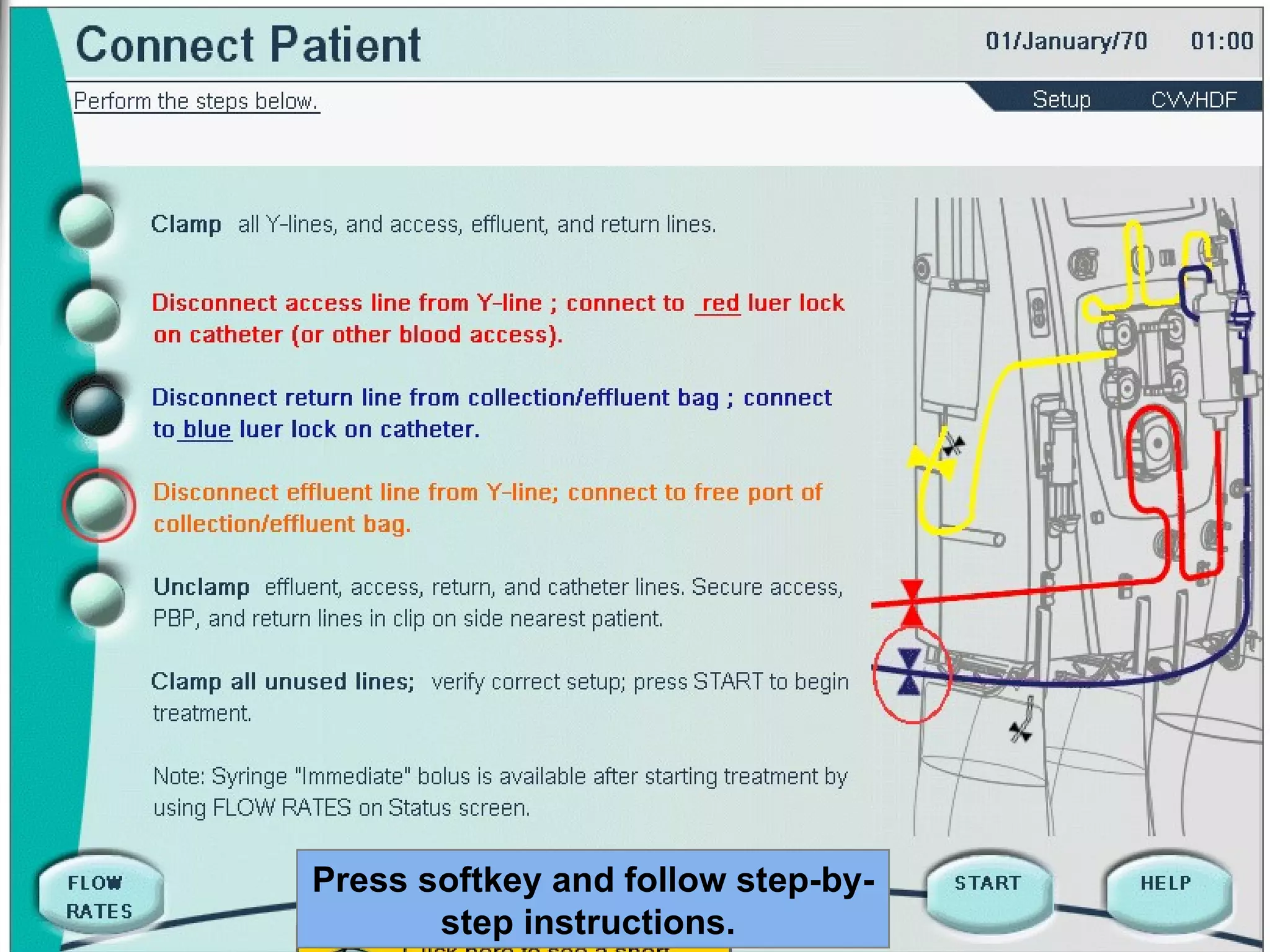 3 prismaflex basic setup operation | PPT