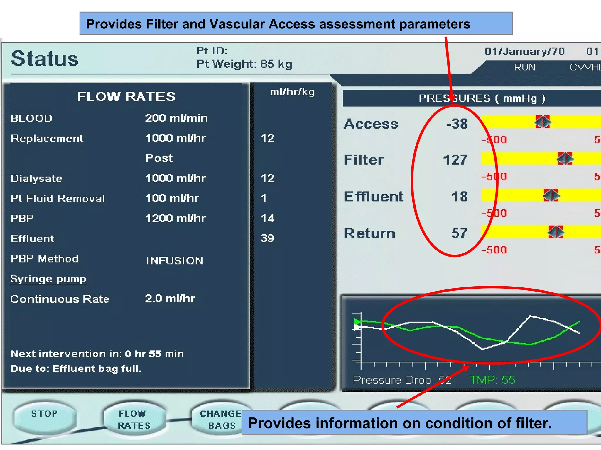 3 prismaflex basic setup operation | PPT