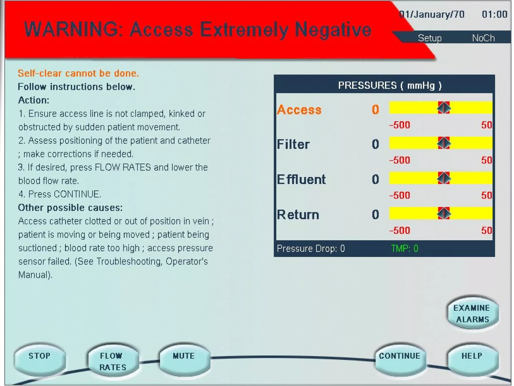 3 prismaflex basic setup operation | PPT