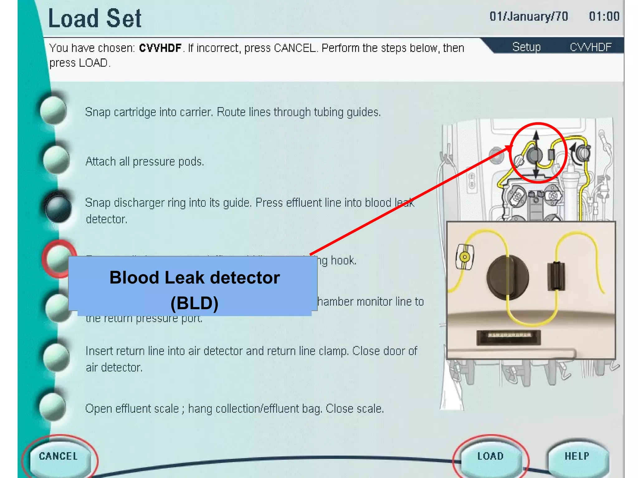 3 prismaflex basic setup operation | PPT