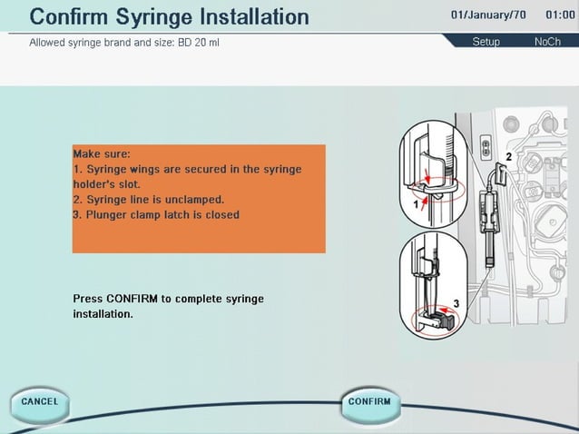 3 prismaflex basic setup operation | PPT
