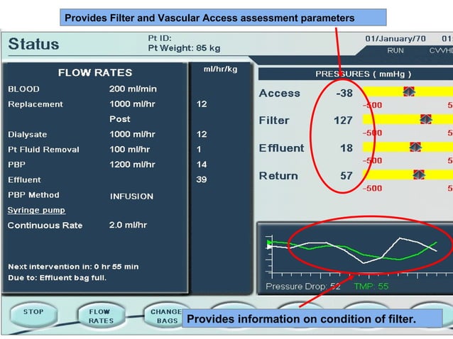 3 prismaflex basic setup operation | PPT