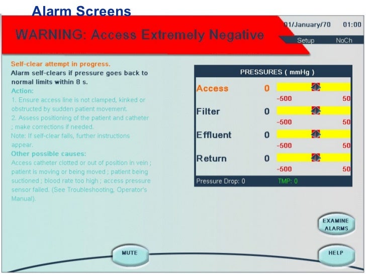 3 prismaflex basic setup operation