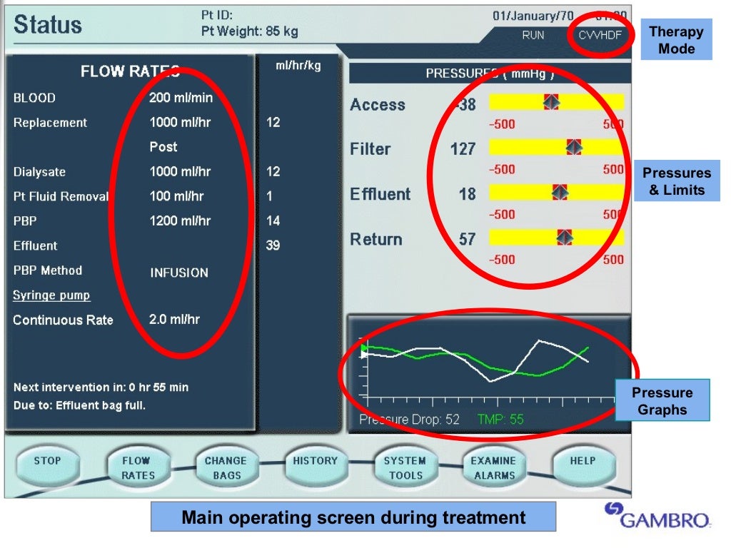 3 prismaflex basic setup operation