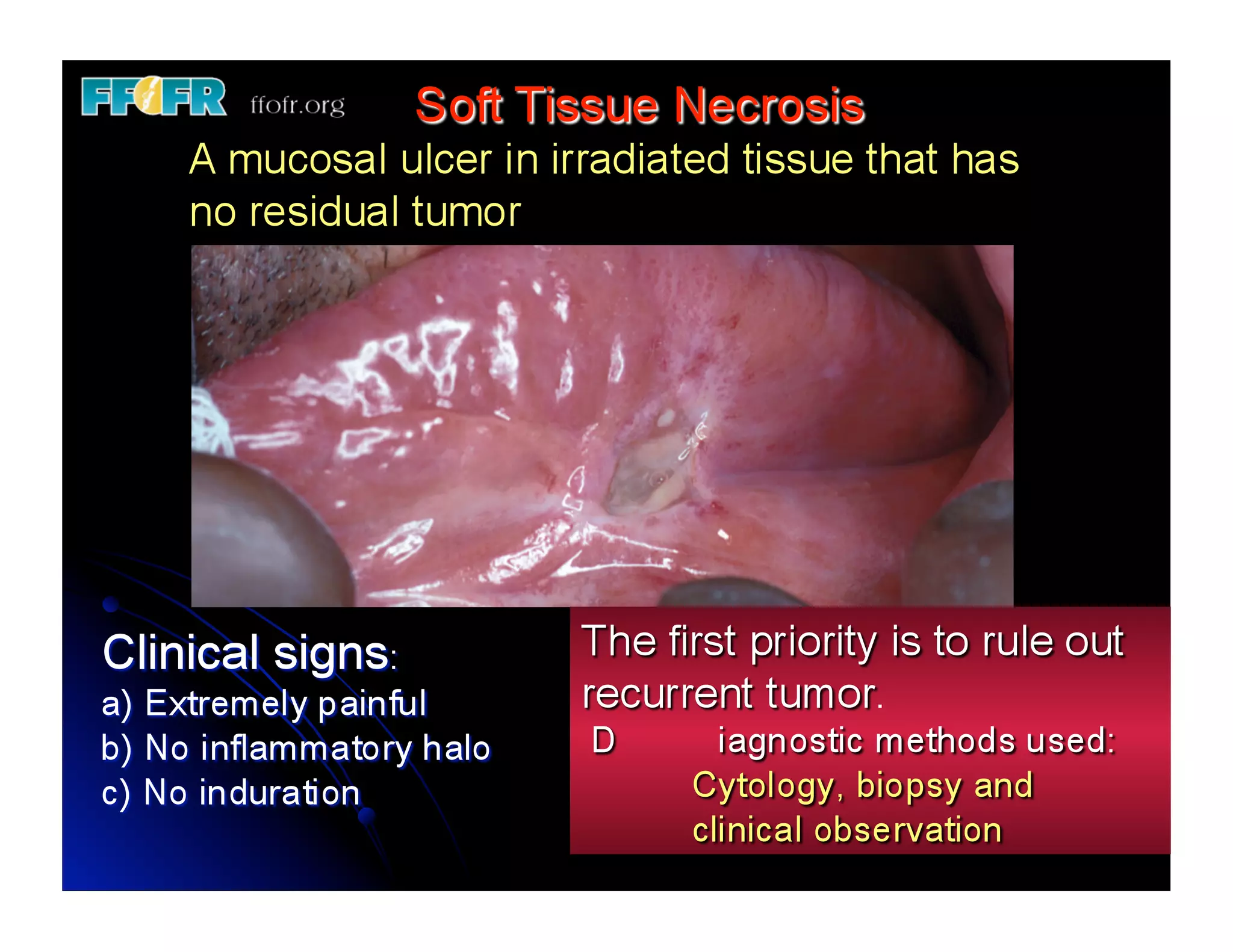 3.radiation effects mucosa, taste, jaw opening | PPT