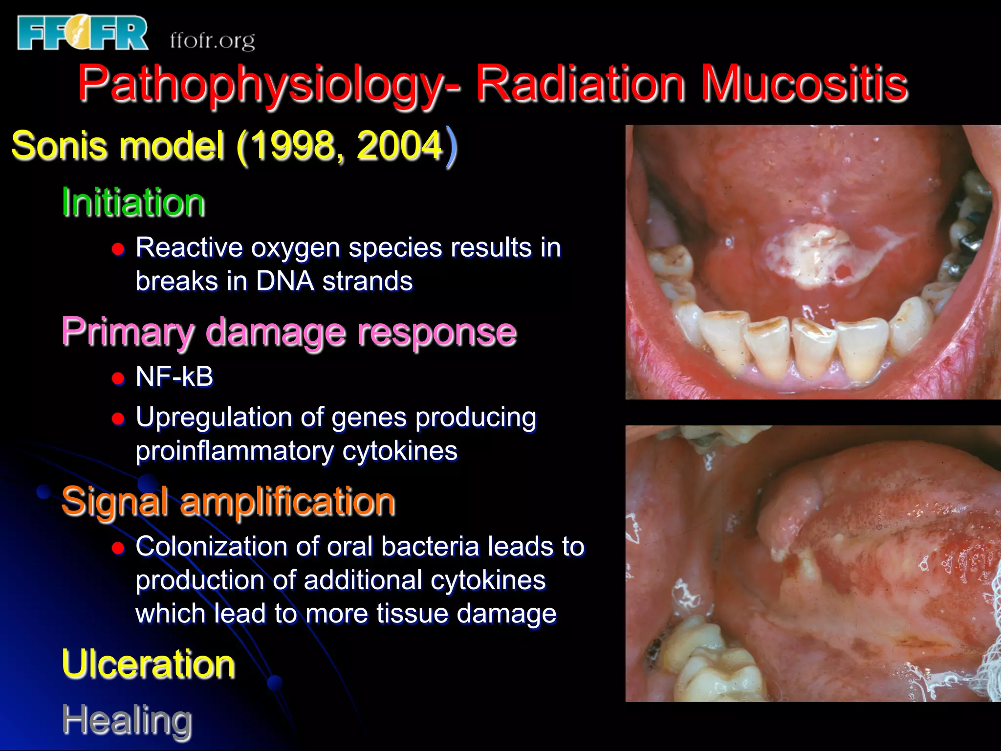 3.radiation effects mucosa, taste, jaw opening | PDF