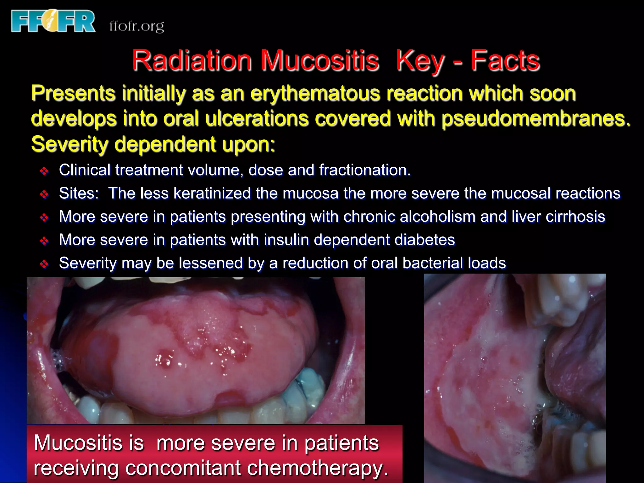 3.radiation effects mucosa, taste, jaw opening | PDF