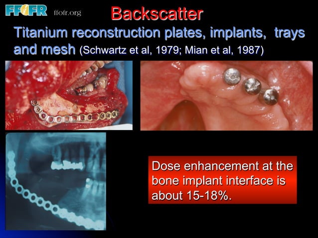 3.radiation effects mucosa, taste, jaw opening | PDF | Digestive ...