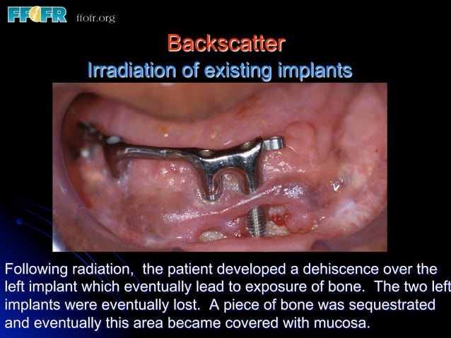3.radiation effects mucosa, taste, jaw opening | PDF | Digestive ...