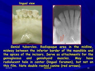 Lingual Foramen And Genial Tubercle