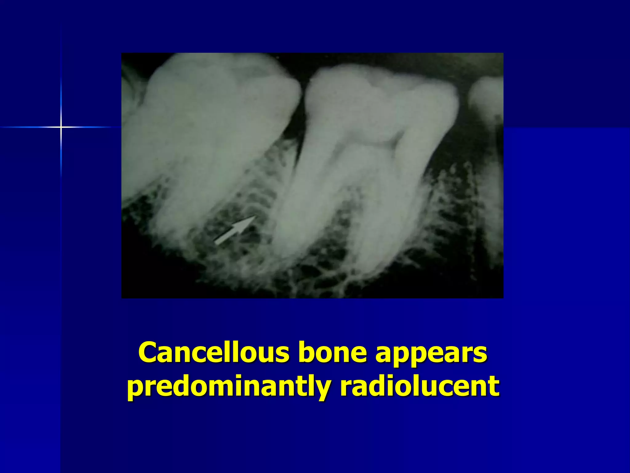 Radiographic Anatomical Landmarks | PPSX