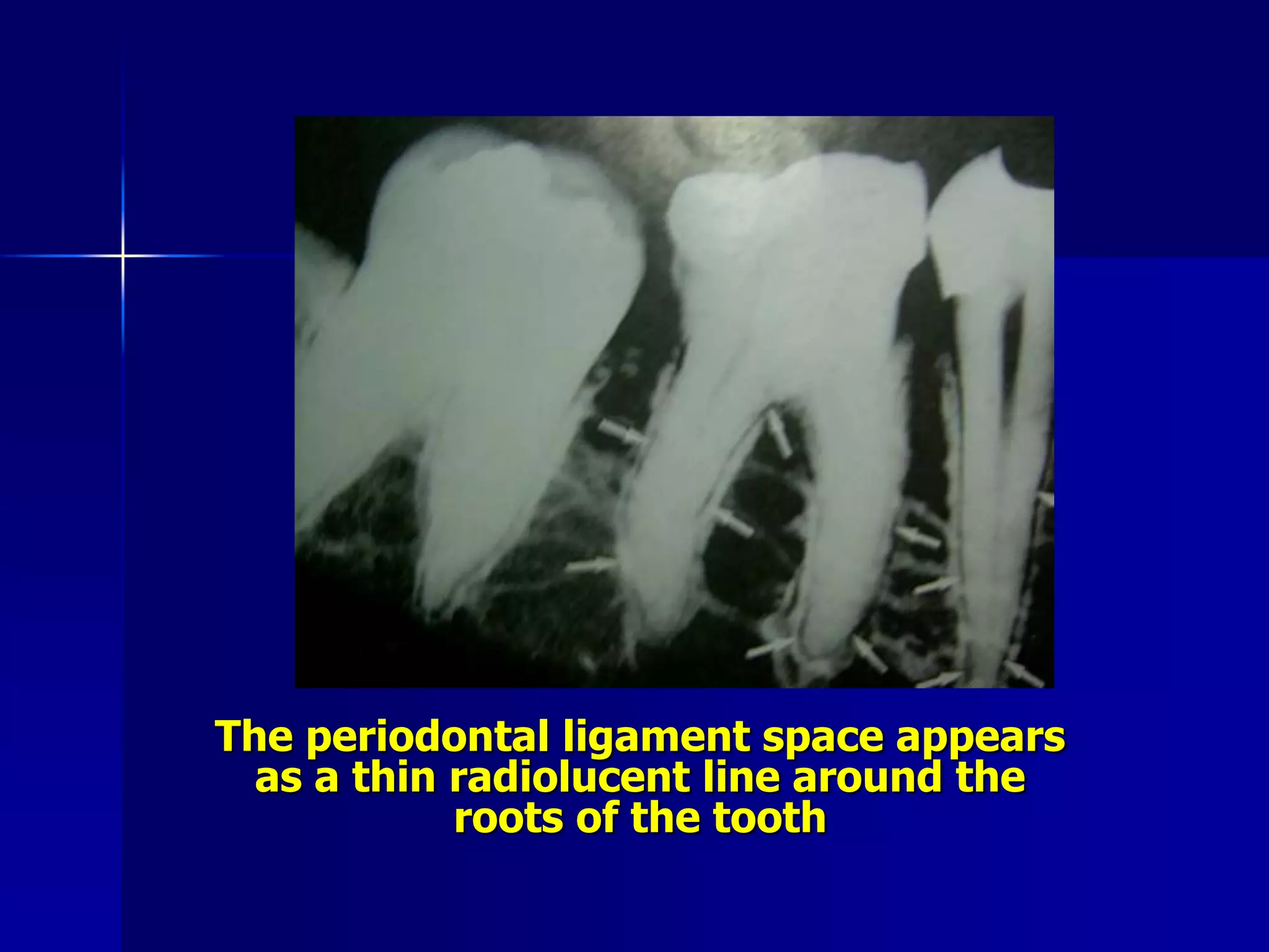 Radiographic Anatomical Landmarks | PPSX