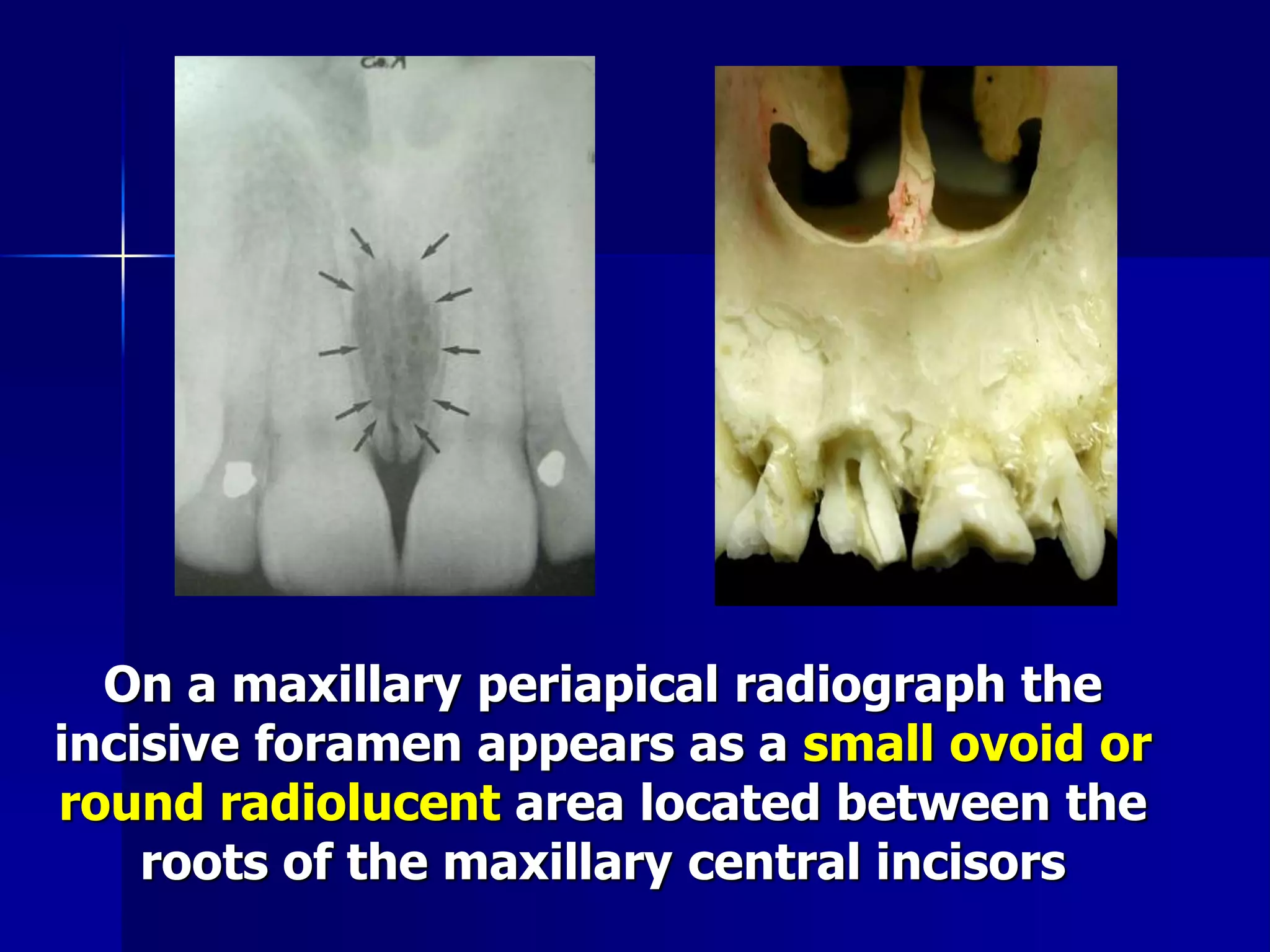 Radiographic Anatomical Landmarks | PPSX