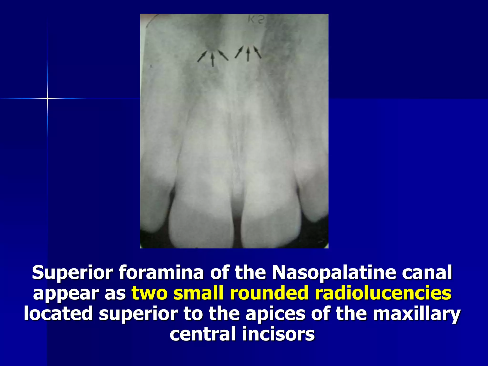 Radiographic Anatomical Landmarks | PPSX