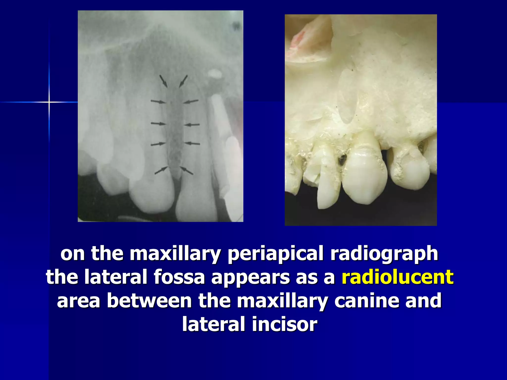 Radiographic Anatomical Landmarks | PPSX