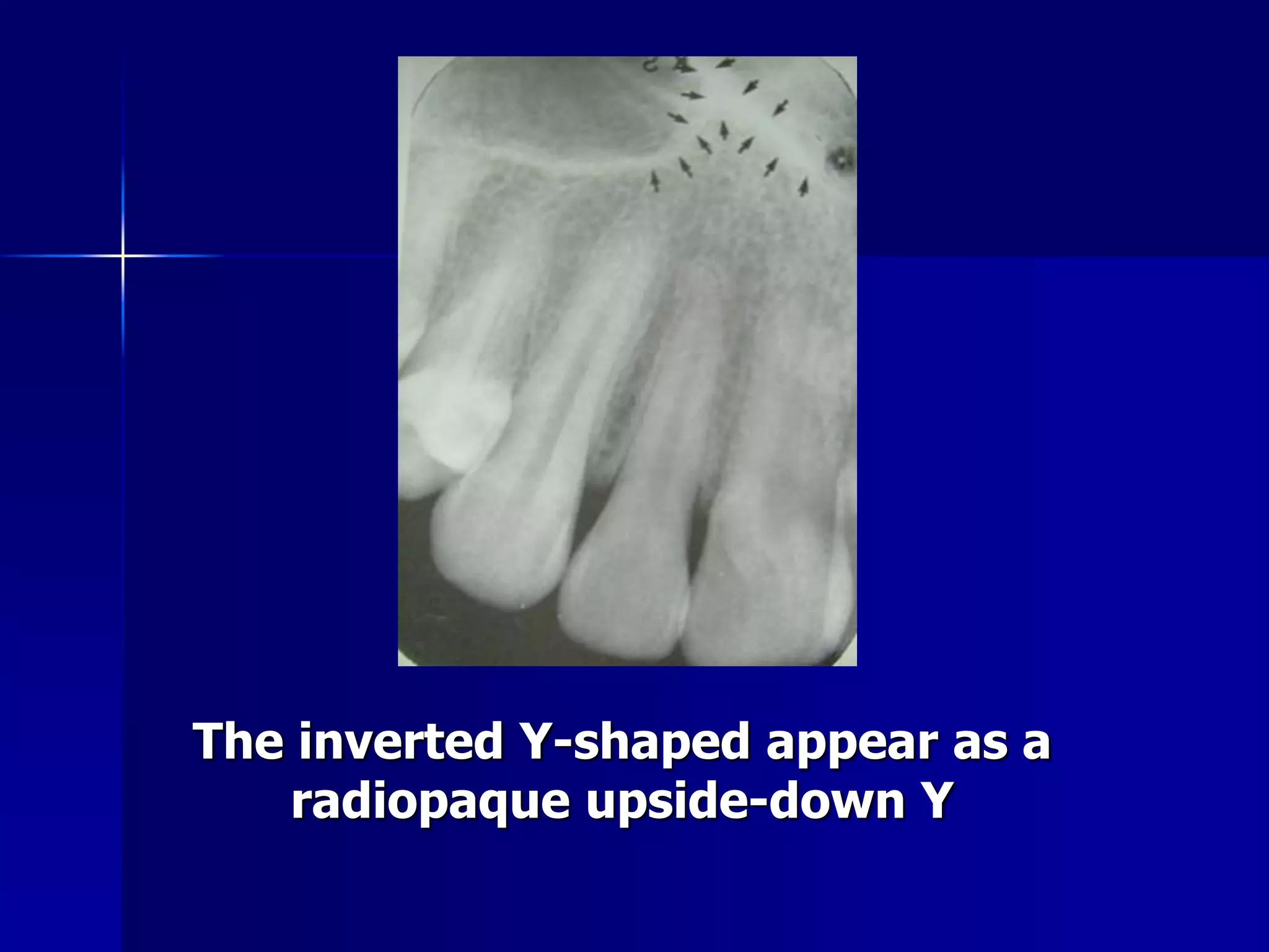 Radiographic Anatomical Landmarks | PPSX