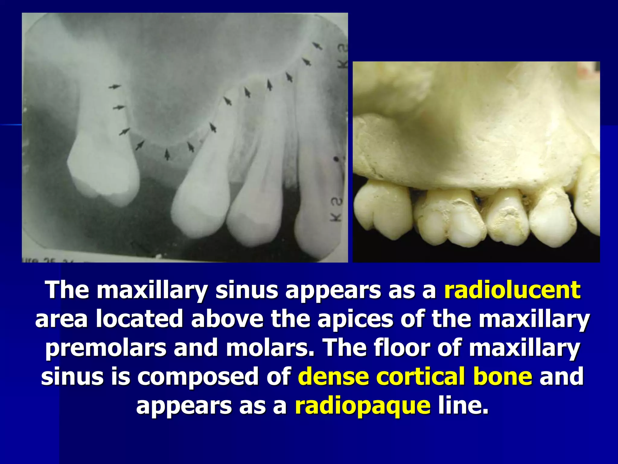Radiographic Anatomical Landmarks | PPSX