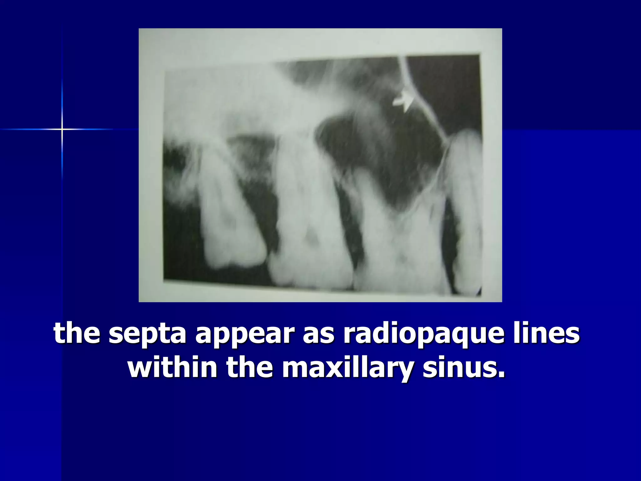 Radiographic Anatomical Landmarks | PPSX