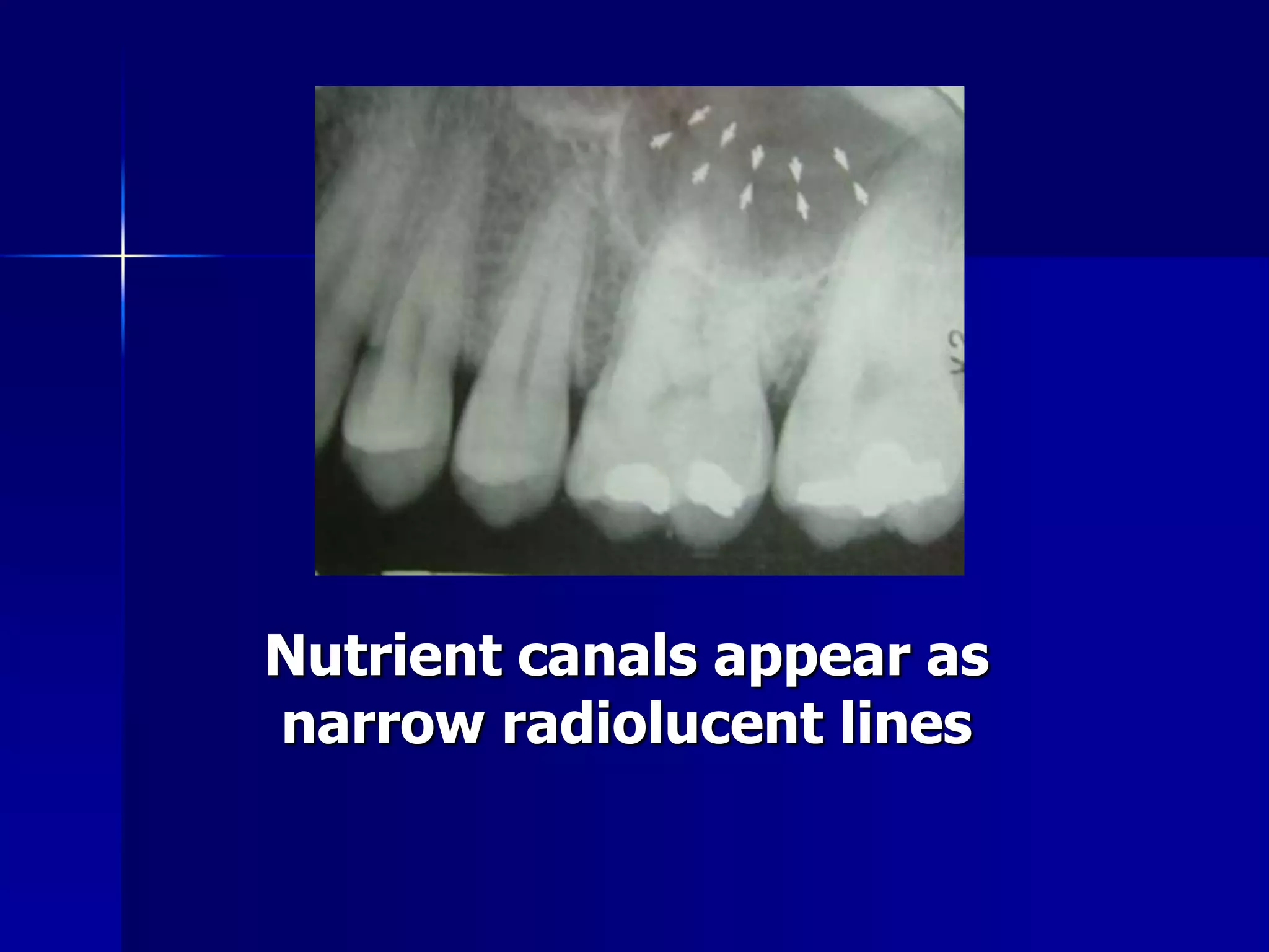 Radiographic Anatomical Landmarks | PPSX | Dental Health | Diseases and ...