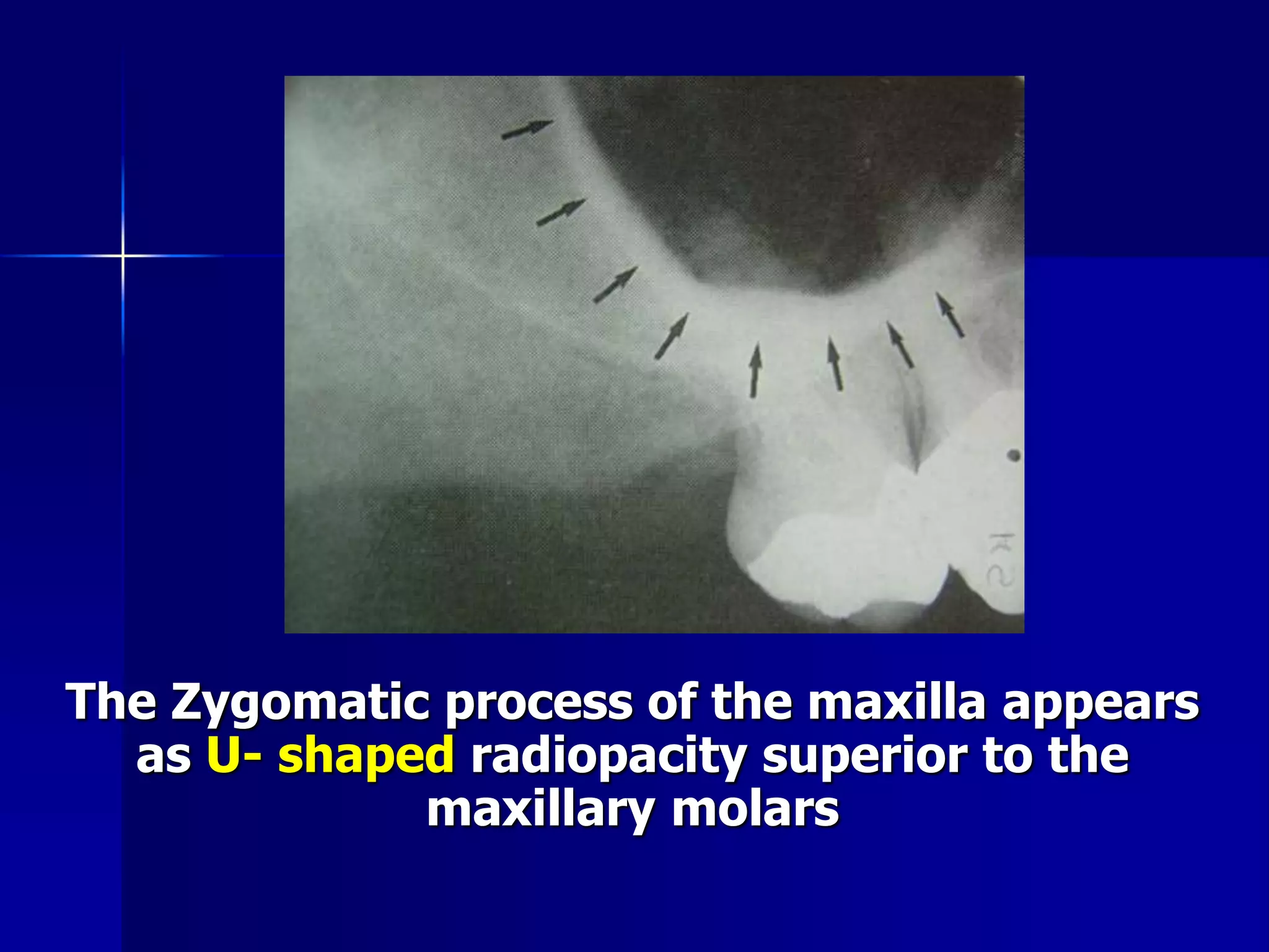 Radiographic Anatomical Landmarks | PPSX