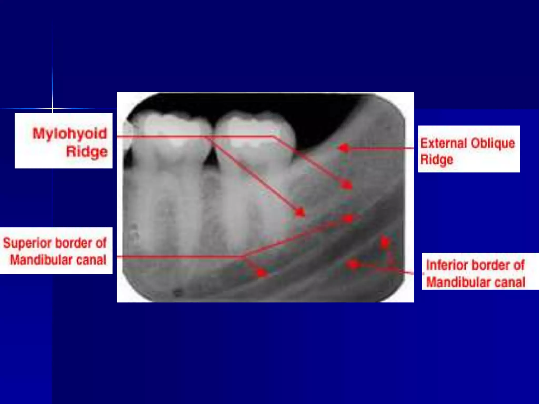 Radiographic Anatomical Landmarks | PPSX