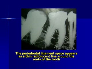 Radiographic Anatomical Landmarks | PPSX
