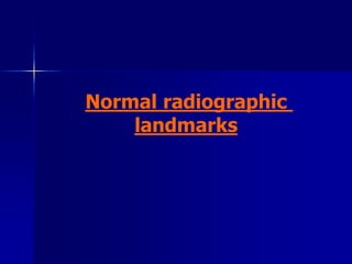 Radiographic Anatomical Landmarks | PPSX